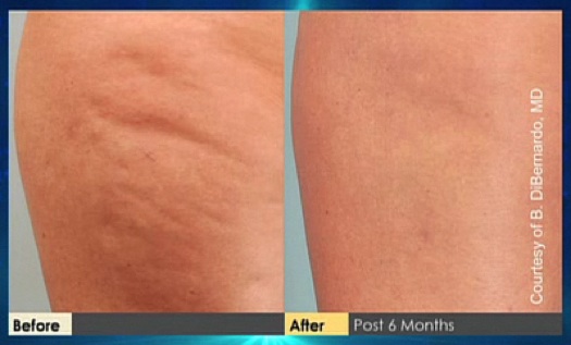 Vegas Cosmetic Surgery 2012, 50 Shades of Gray, and Beauty Secrets ...