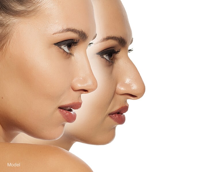 Michael A. Persky, M.D., F.A.C.S. | Encino, CA Plastic Surgeon